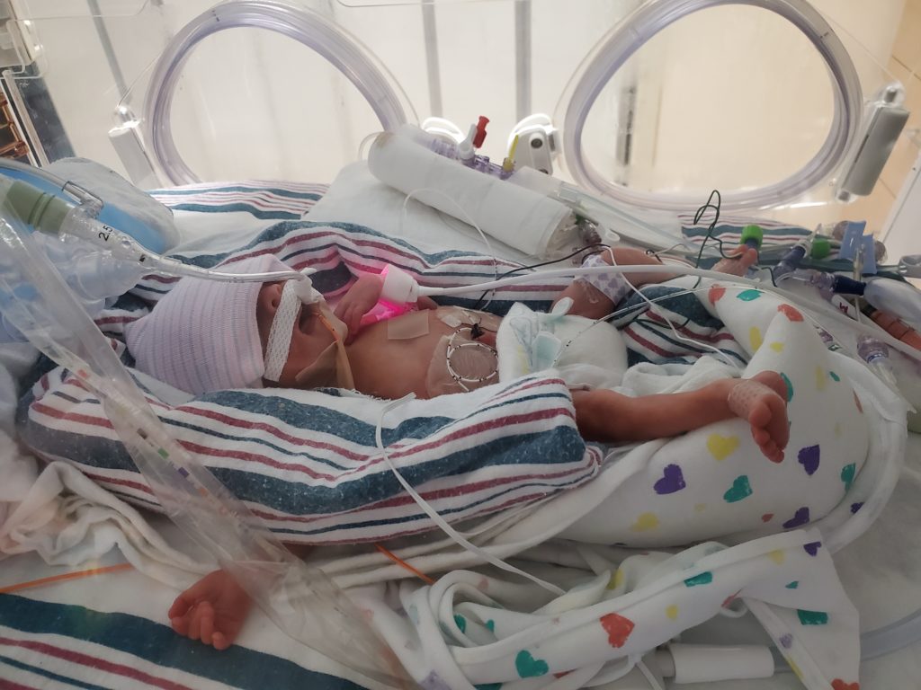 NICU Parent Perspective: Despite a Challenging NICU Stay, We Have Many ...