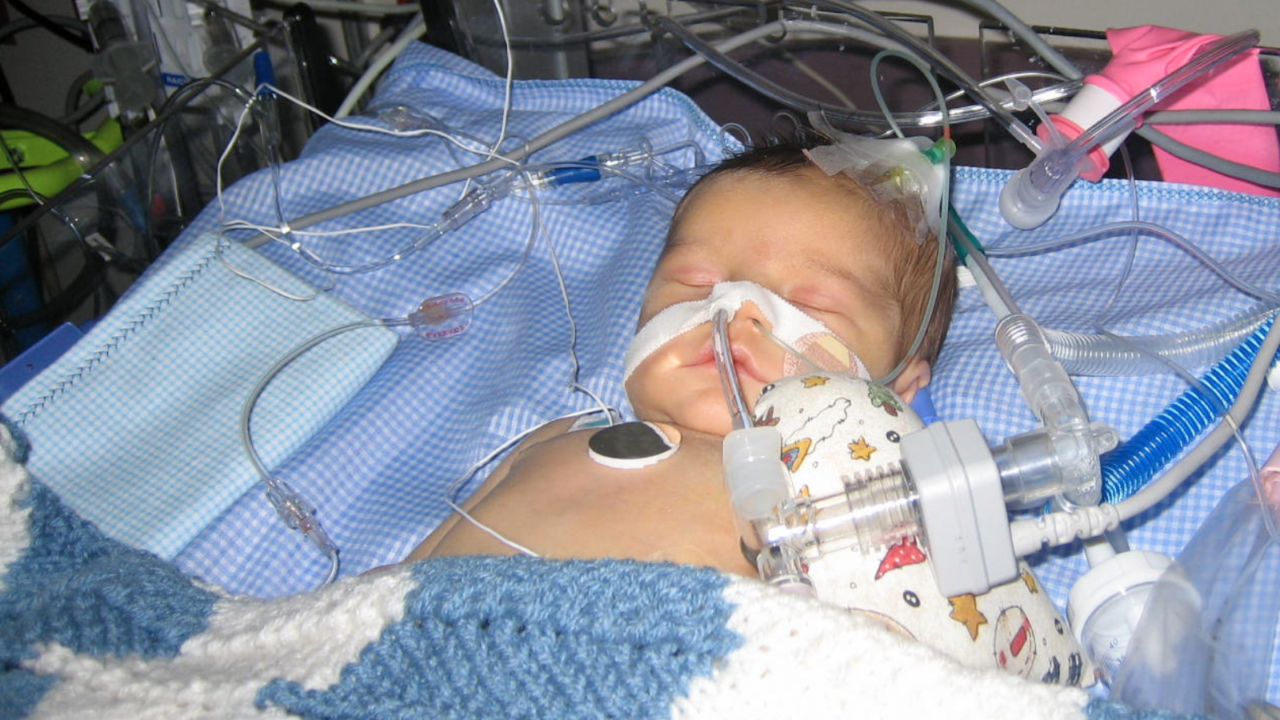 A Second NICU Stay; an Unexpected Heart Surgery - Hand to Hold
